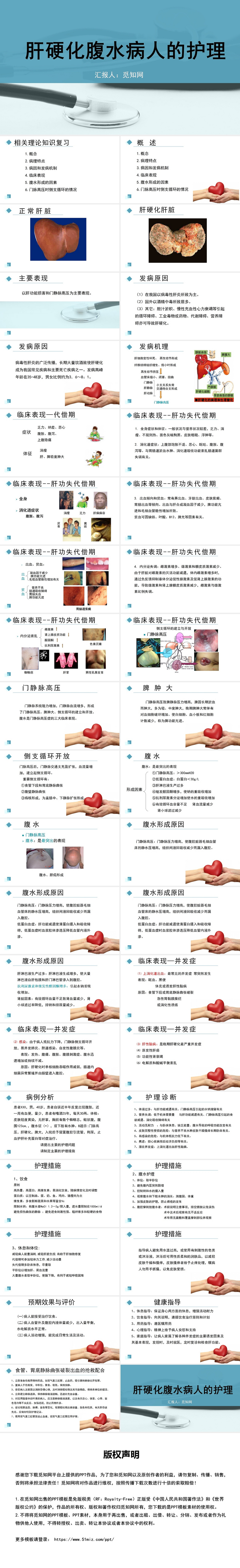蓝色简约风肝硬化腹水病人的护理PPT模板肝硬化患者护理查房 二哈办公